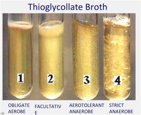 Growth Of Anaerobic Bacteria Flashcards Quizlet