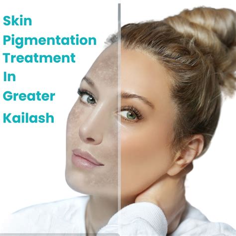 How To Remove Dark Spots Caused By Pimples Dermatologist Approved