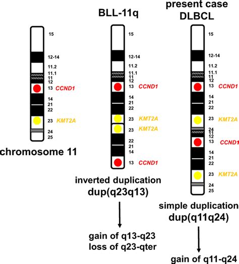 Ideograms Of G Banding Patterns For The Duplication Of Chromosome 11q