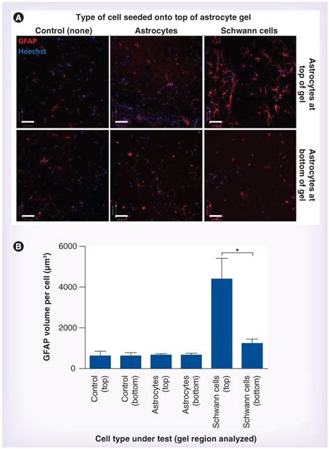 Astrocyte Reactivity In Response To Control Cells Download Scientific Diagram