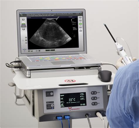 Evaluation Of Uterine Patency Following Transcervical Uterine Fibroid