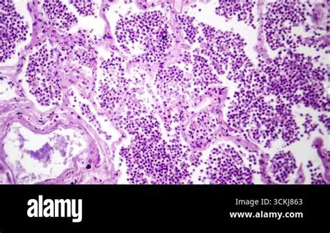 Human Cerebellar Cortex Light Microscopy Showing Purkinje Cells Granular Cells And Molecular