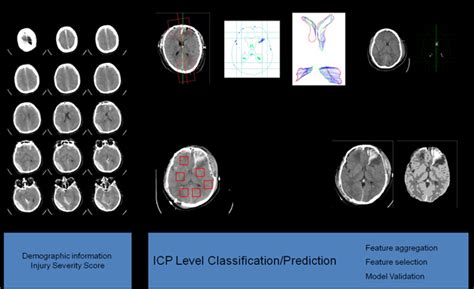 Automated Midline Shift And Intracranial Pressure Estimation Based On