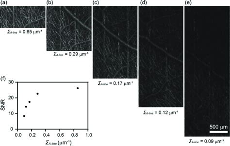 The Effect Of The A Line Scanning Density Within A B Scan On Human Download Scientific Diagram