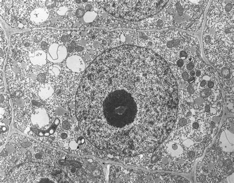 Nucleus Micrograph Transmission Electron Micrograph Nucleus Thank