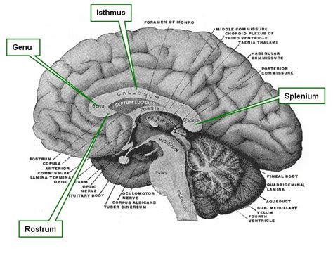 Corpus Callosum
