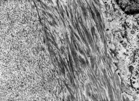 Collagen Fibres Tem Stock Image C061 0070 Science Photo Library