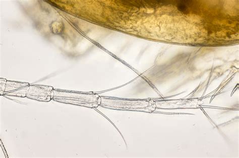 Macrocyclops Albidus The Microscopic Life Of Shetland Lochs
