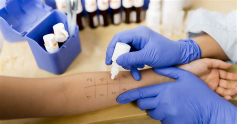 Allergy Tests Explained