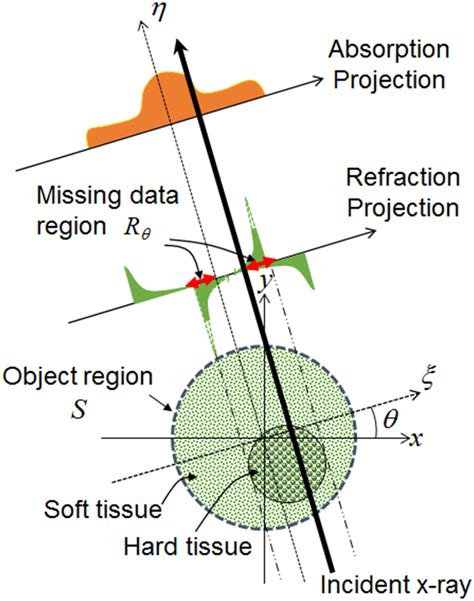 The Main Intuition Behind The Artefact Reduction Algorithm Since The Download Scientific