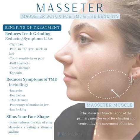 Dr Tmj Treatment With Neuromodulators Benefits 1 Stops Grinding