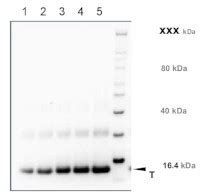 Anti Pr 1 Pathogenesis Related Protein 1 Antibody