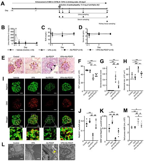 Preventive Effect Of Podocytopathy By Gm3 Via Administration Of Vpa In