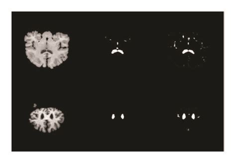 Network Training Output The First Column Is Csf Training Epoch Download Scientific Diagram