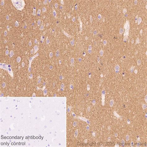 Anti Alpha Synuclein N Term Antibody Epr29522 6 Ab324977 Abcam