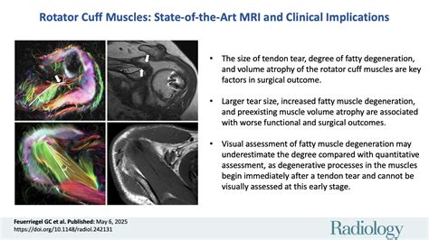 Assessment Of The Rotator Cuff Muscles State Of The Art Mri And