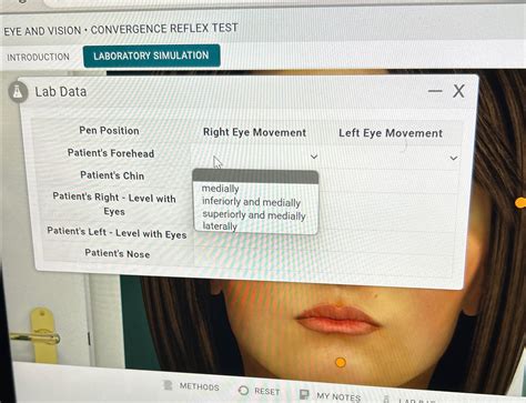 Solved Eye And Vision ﻿convergence Reflex