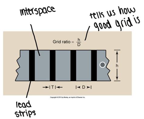 Grids Flashcards Quizlet