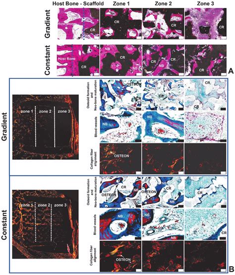 Histological Assessment Of Neo Bone Formation A Basic Fuchsin And