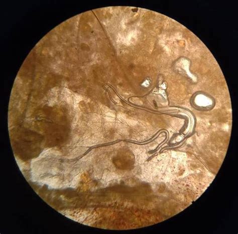 Clinical Diagnostics Specialist Malaysia Can Anyone Identify What Parasite Is This Facebook