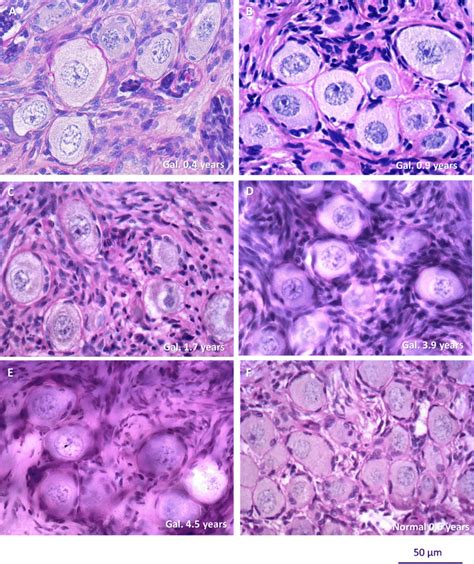 ovarian cortex
