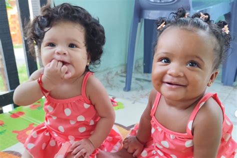 Gêmeas Brasileiras Com Cor De Pele Diferente Estão Lindas Após Quase 1
