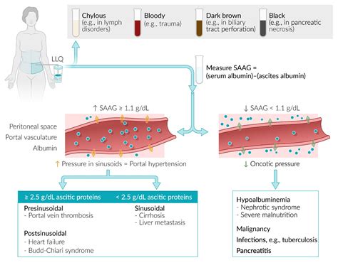 Ascites Fluid Analysis