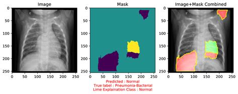 Comprehensive Lung Disease Detection Using Deep Learning Models And