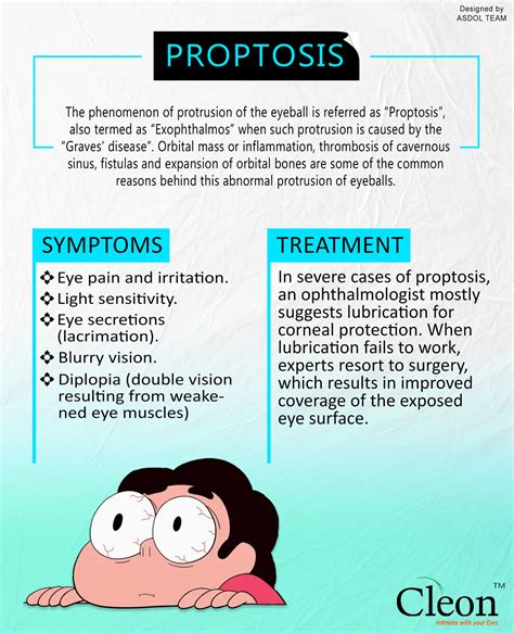 Asdol Proptosis The Phenomenon Of Protrusion Of The Eyeball Is
