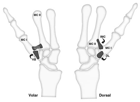 Carpometacarpal Joint