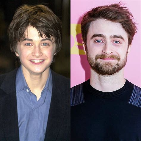 Harry Potter Cast Then And Now Neville Harry Potter Actors Then And