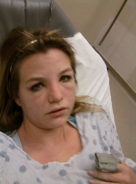 Allergic Reactions That Actually Hurt To Look At