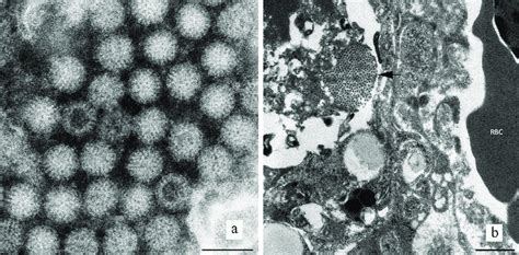 A Negative Contrast Electron Microscopy Revealed Non Enveloped Viral Download Scientific