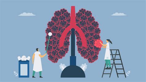 Lung Disease Flat Design 1212726 Vector Art At Vecteezy