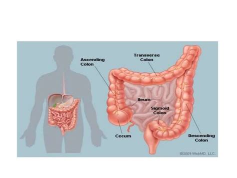 Colostomy Care And Role Of Nurses In Management In Patient With Colostomy Pptx