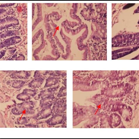 Histoligical Image Of Rat Ileum 400x Enlargement Note A Healthy