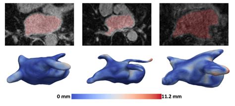 Qualitative Results On Left Atrium These Shows Three Samples From The Download Scientific