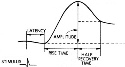 A Gsr Signal Scr Component B An Ideal Ecg Signal Download