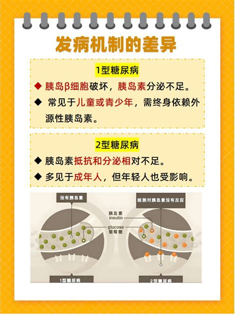 1型与2型糖尿病哪个更严重？两者其实有很大差异！ 家庭医生在线家庭医生在线首页频道