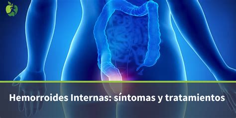 Hemorroides Internas Síntomas Causas Y Cuidados Dietetica Ferrer