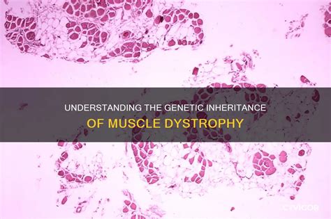 Understanding The Genetic Inheritance Of Muscle Dystrophy Cyvigor