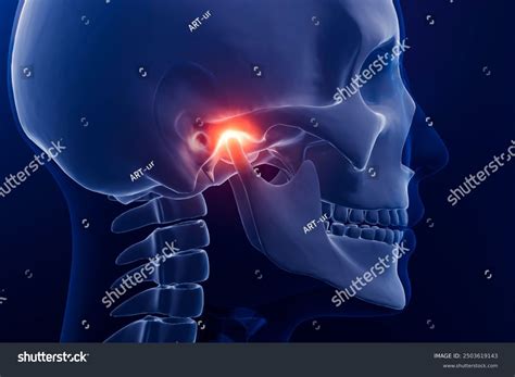 Temporomandibular Joint Jaw Pain 3d Illustration Stock Illustration