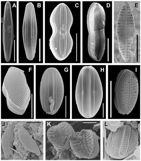 JMSE Free Full Text Seasonal Dynamics Of Microphytobenthos Distribution In Three Ecotopes On