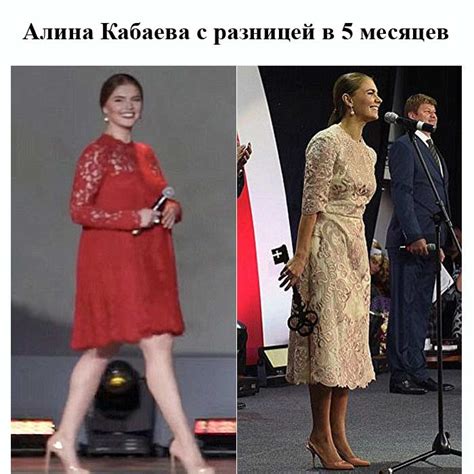 Кабаева Алина Последние Фото После Операции Пластической — Картинки фотографии