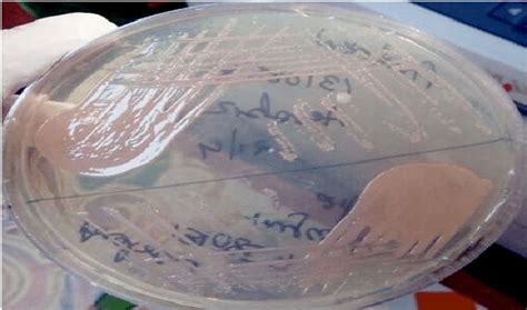 Extended­spectrum­â­lactamaseesbl Producing Paeruginosa Detection By Download Scientific