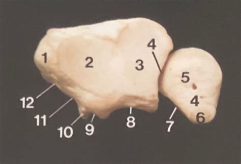 Schaubild „radius Et Ulna Dr Vue Inf“ Quizlet