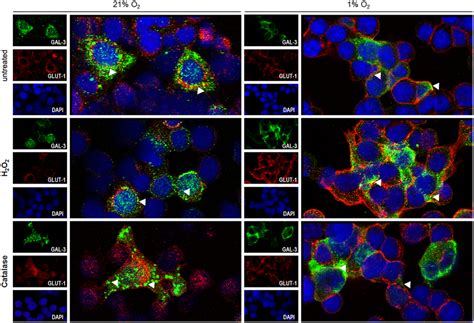 Subcellular Localization Of Galectin And GLUT Subcellular Download Scientific Diagram