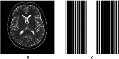Figure 5 From Bi Dictionary Learning Model For Medical Image Reconstruction From Undersampled