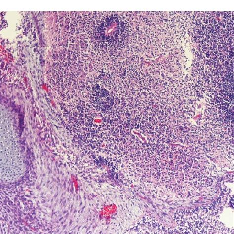 Mature Components Of All The Three Germ Cell Layers Download