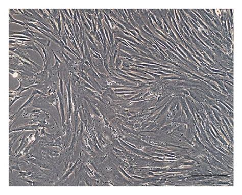 Small Round Cell Osteosarcoma Finite Cell Line Observation In Phase